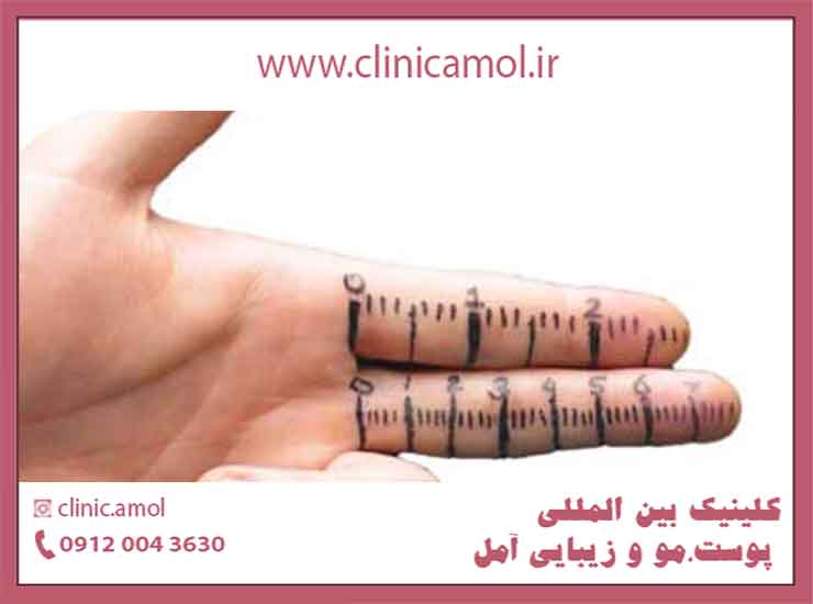 بهترین روش بزرگ کردن آلت تناسلی کلینیک بین المللی پوست و مو زیبایی آمل